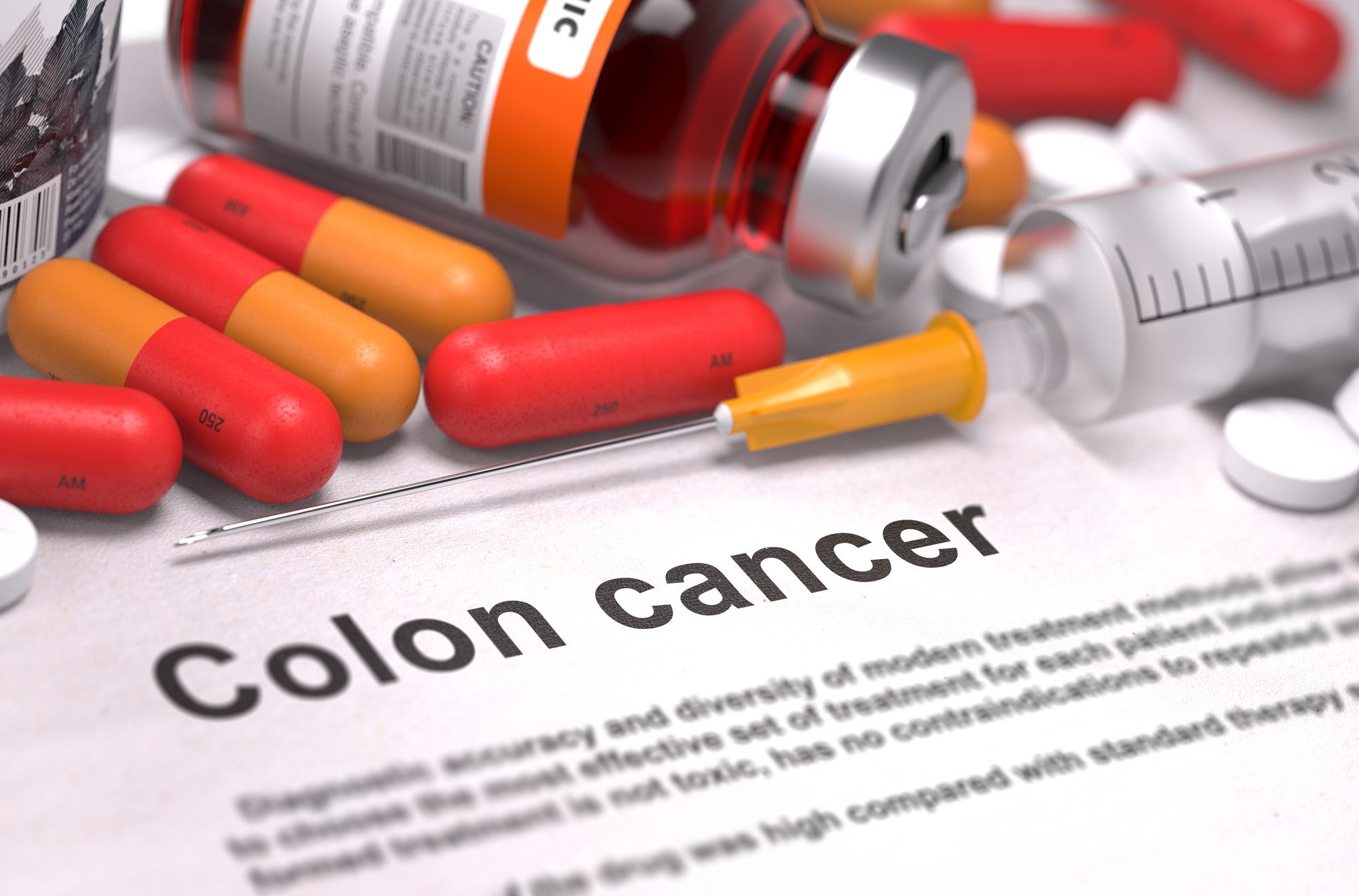 Signs Of Colon Cancer: Do They Hurt? - The Daily Haze